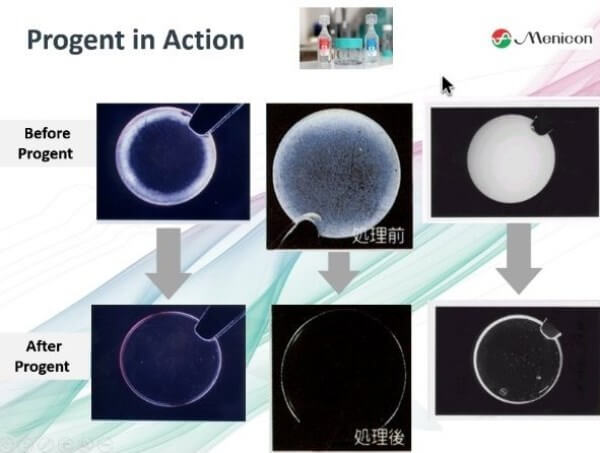 Optometry News - H ιδανική επιλογή καθαρισμού και φροντίδας των σκληρών ...